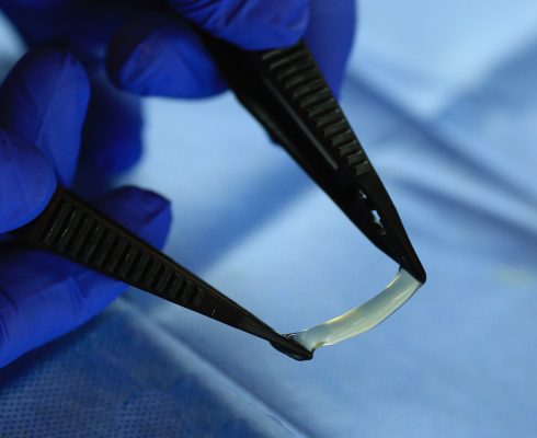 Tissue Technologies - ExtremityCare